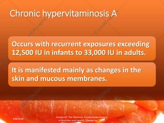 Vitamin A toxicity | PPSX
