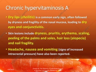 Vitamin A toxicity | PPT