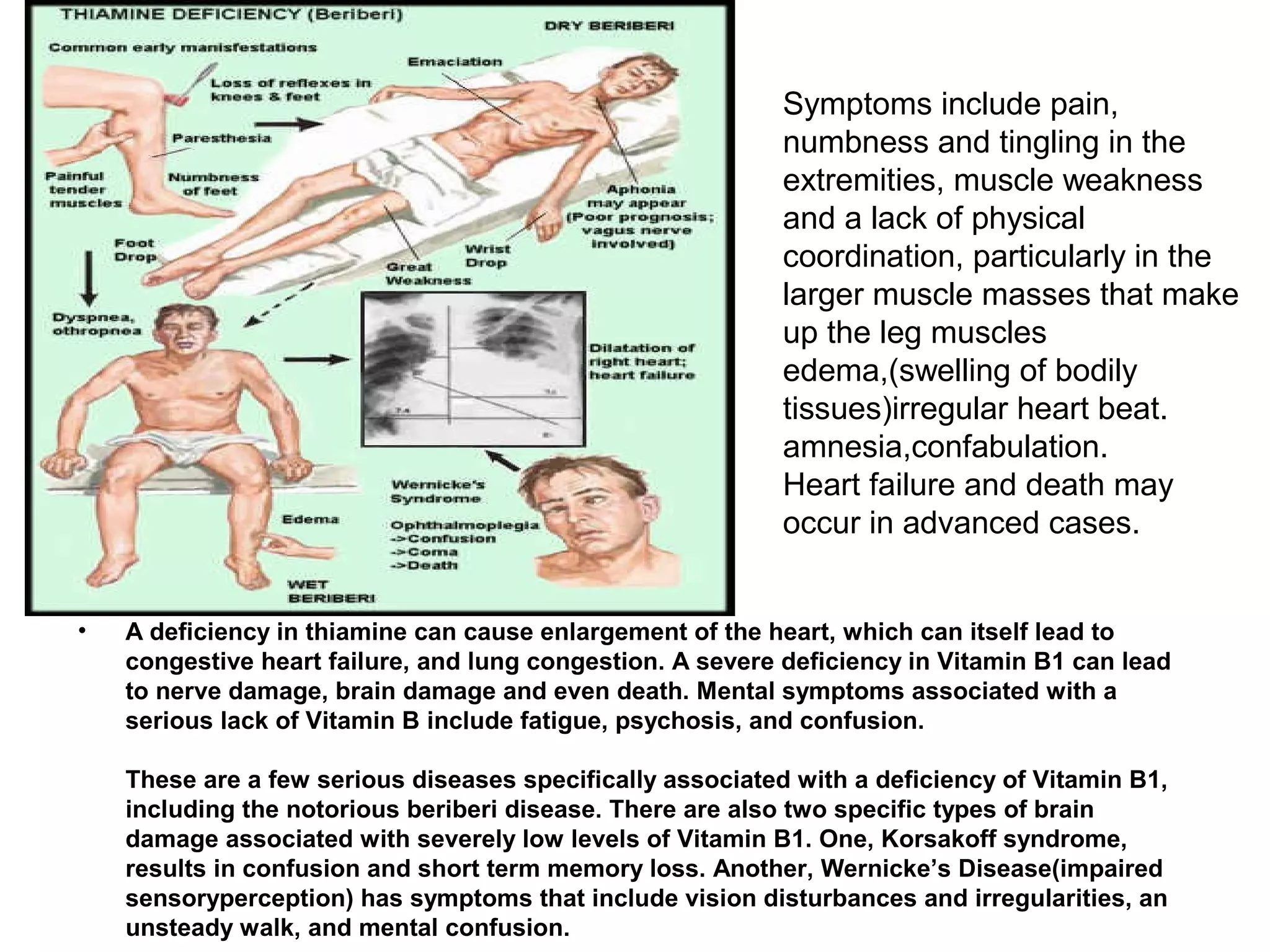 VITAMIN B1 [THIAMINE] MEDICINAL CHEMISTRY BY P. RAVISANKAR [ SOURCE ...