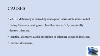 Vitamin B1 _ Thiamine presentation by Ms. Nida Khan .pptx