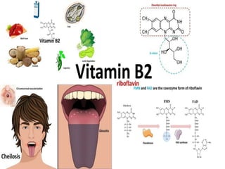Vitamin B2 Deficiency