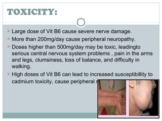 Pyridoxal (Vitamin b6) | PPT