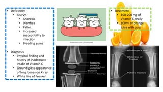 Vitamin B and C.pptx
