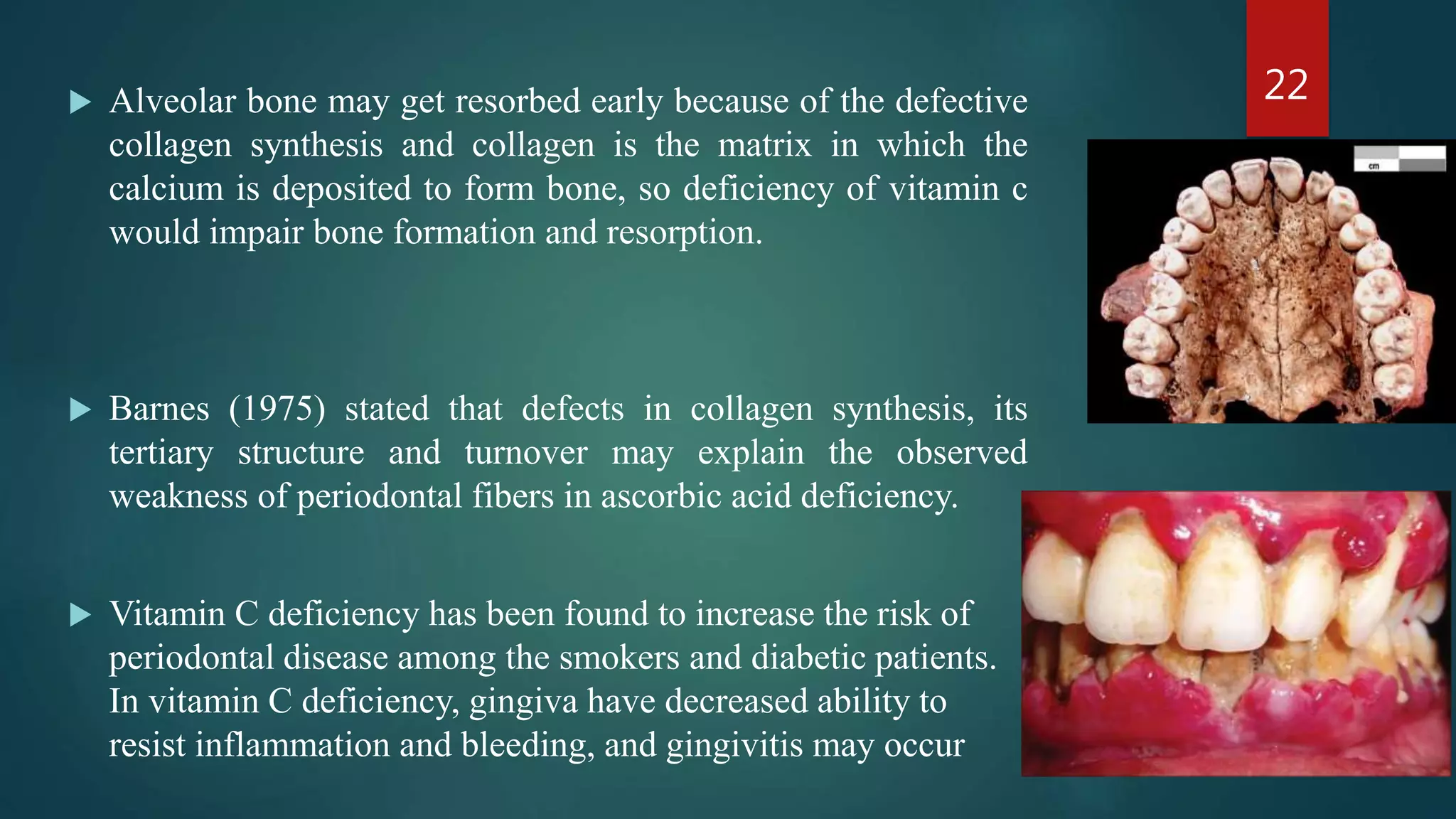 Vitamin C and Periodontal Health | PPTX