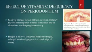 Vitamin C and Periodontal Health | PPTX