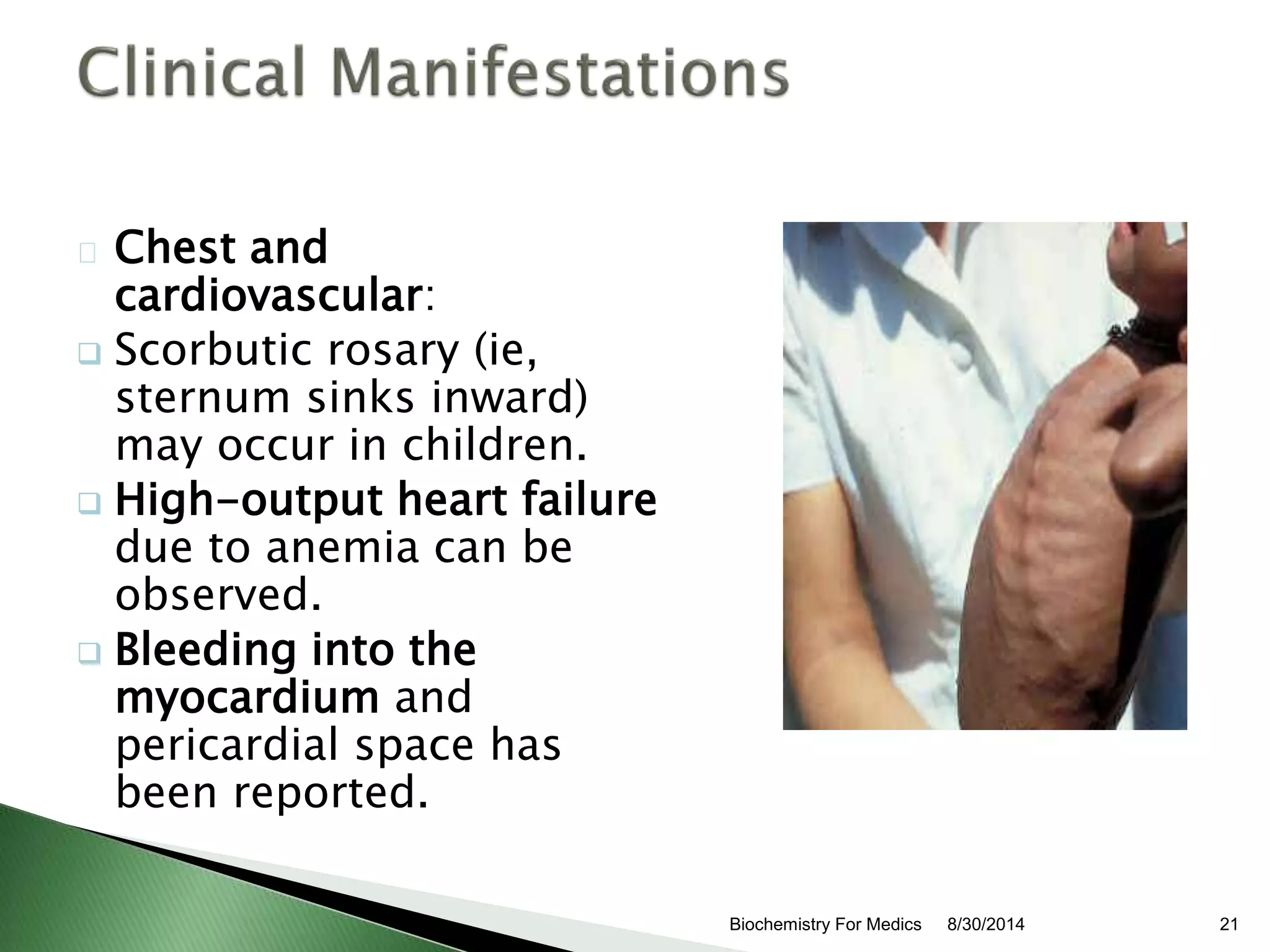 Vitamin C deficiency | PPT