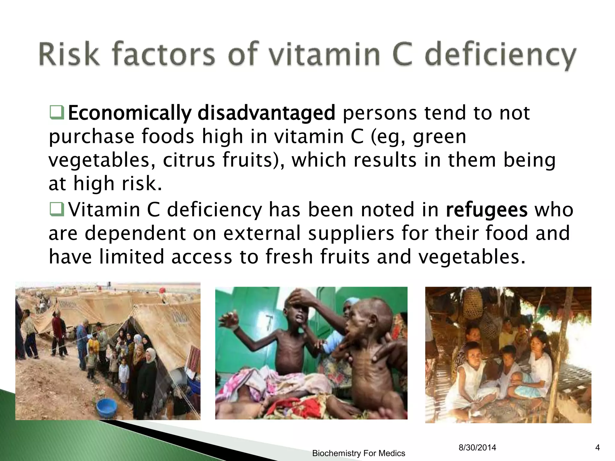 Vitamin C deficiency | PPT