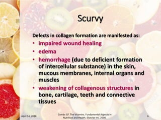 Vitamin C deficiency | PPSX