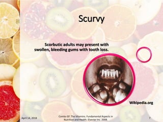 Vitamin C deficiency | PPSX