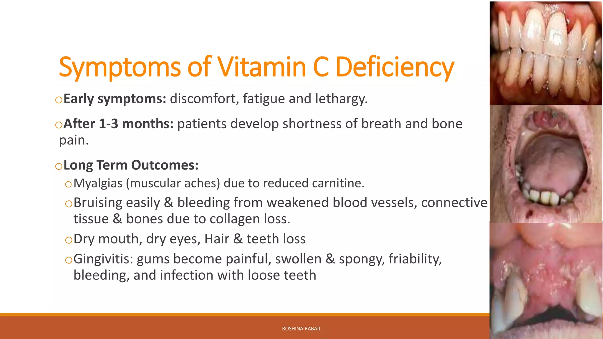 Vitamin c deficiency disorders | PPTX