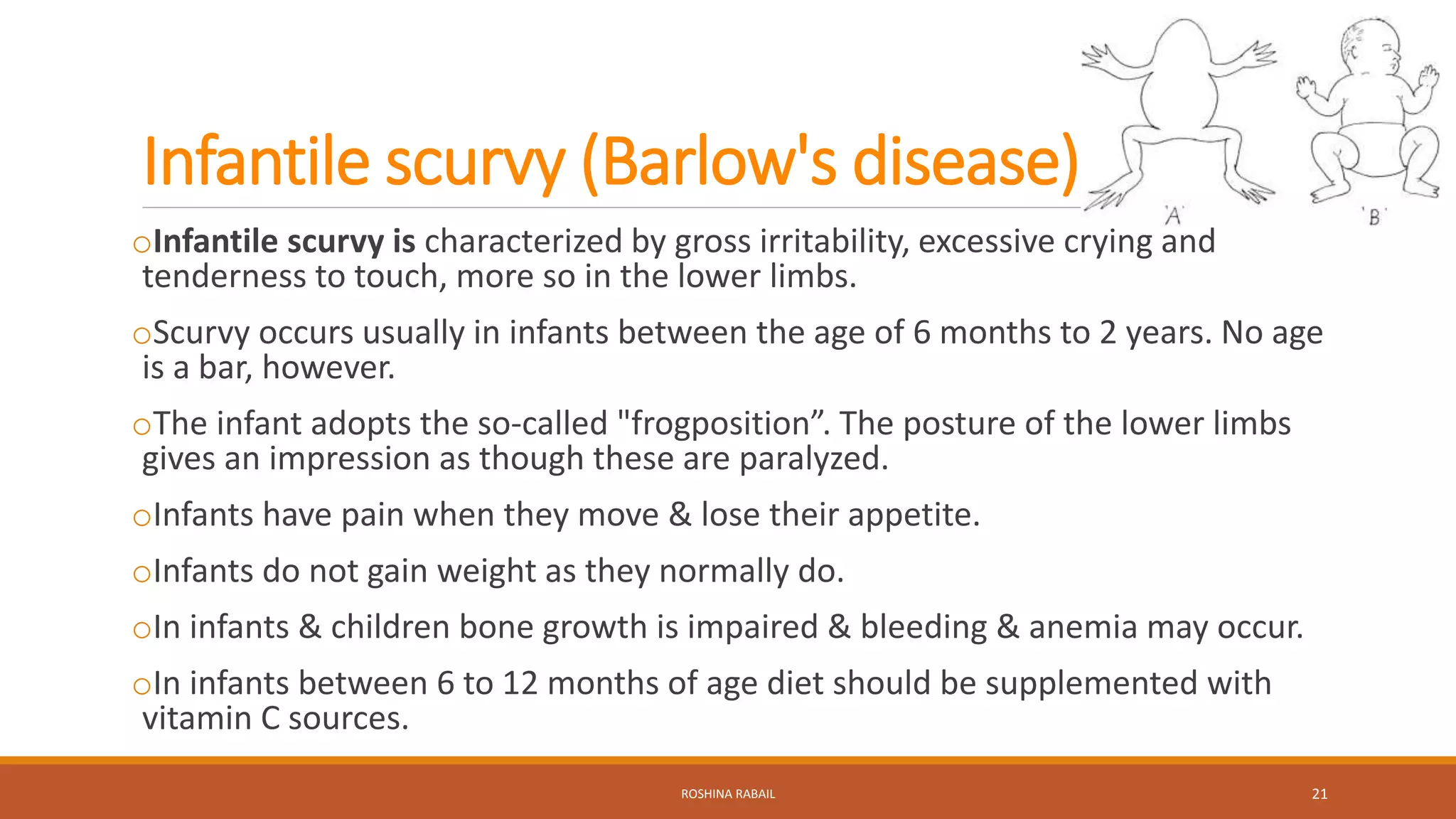 Vitamin c deficiency disorders | PPTX