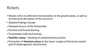 Vitamin D and disorders – hypo/ hypervitaminosis D | PPTX