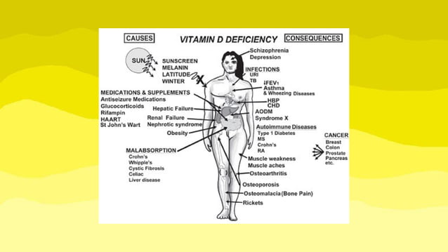 Vitamin D Deficiency Explained | PDF