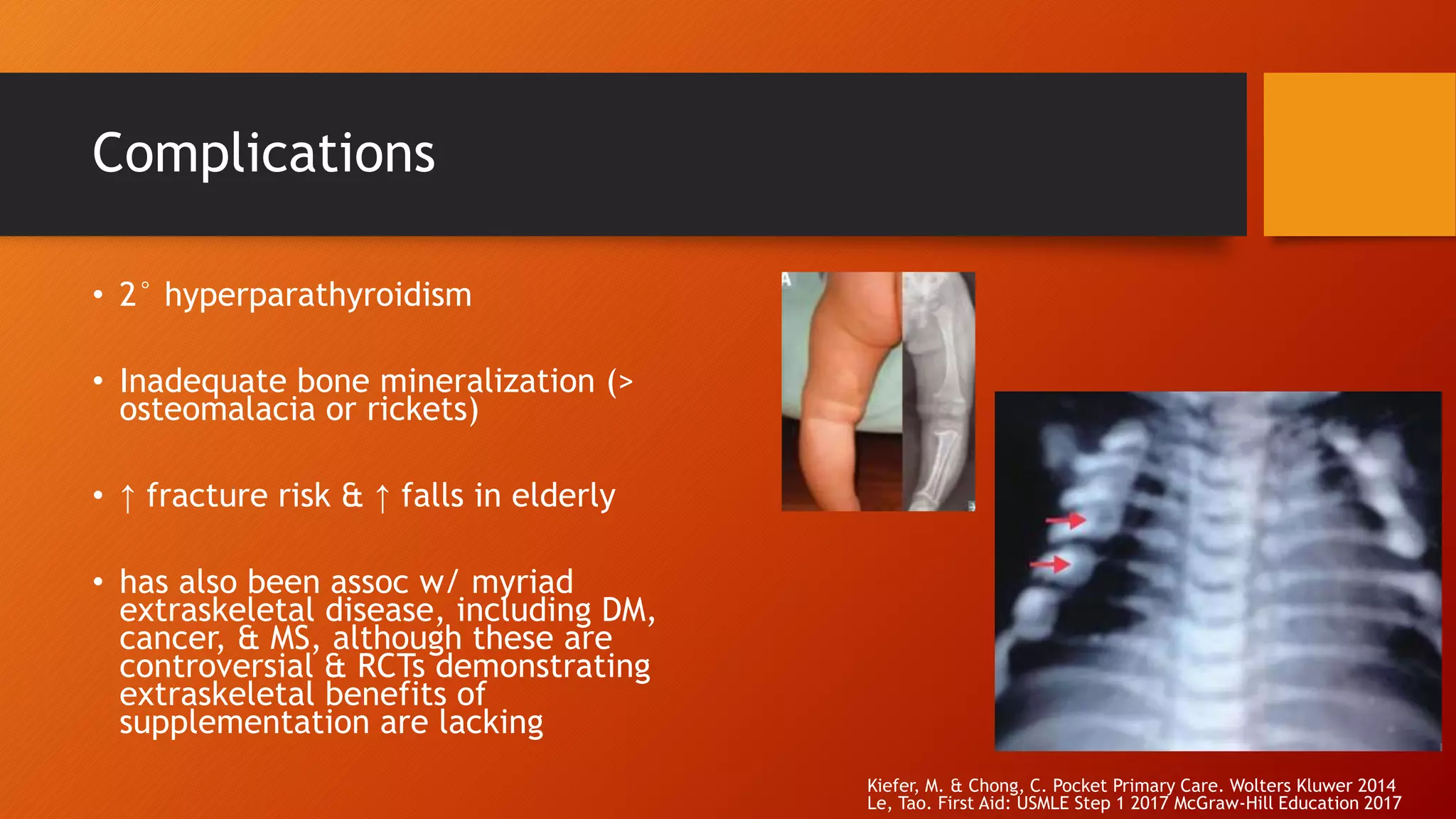 Vitamin D Deficiency | PPTX