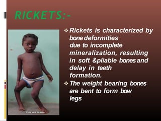 vitaminddeficiencyprats-pptx-121016120516-phpapp02.pptx