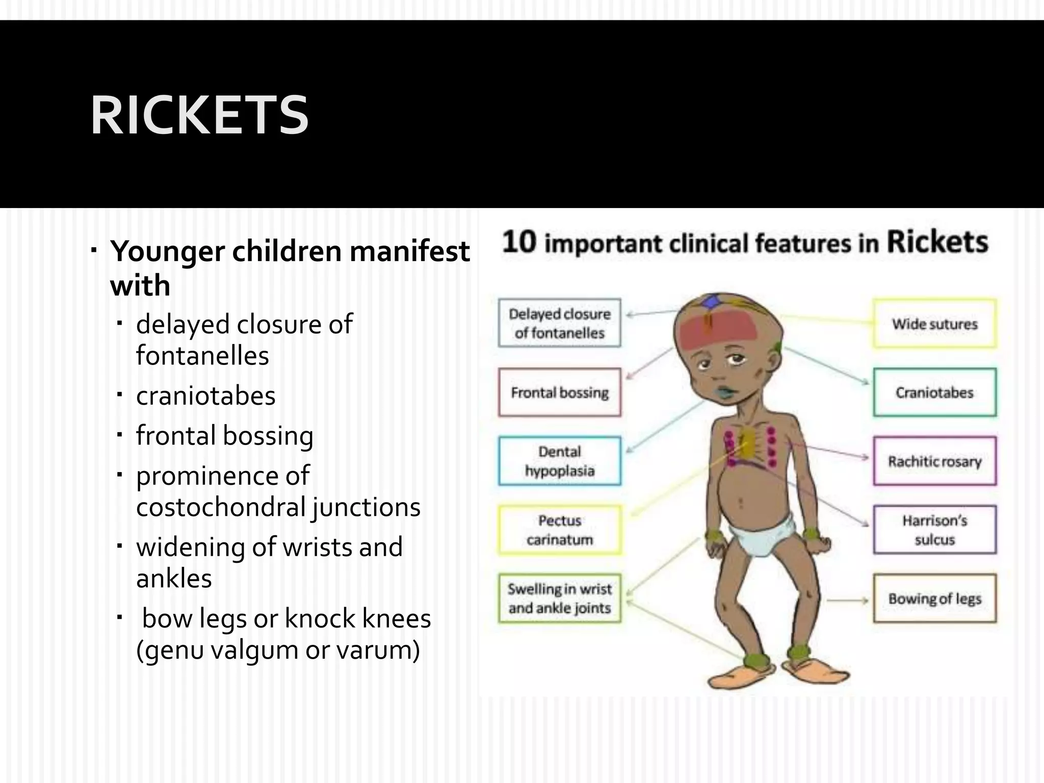 Vitamin d dosing protocol for pediatrics jan 2017 | PPTX