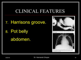 Vitamin D : A Comprehensive Presentation | PPT