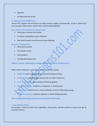 Vitamin Deficiency That Causes Bleeding Gums Causes, Symptoms, and ...
