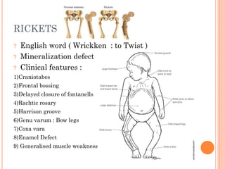 Vitamin D deficiency, description.pptx
