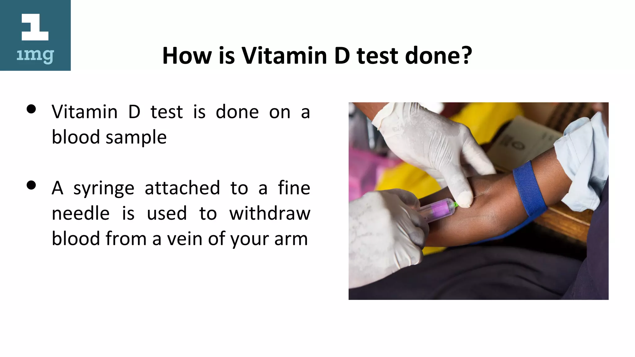 Vitamin D Test | ODP