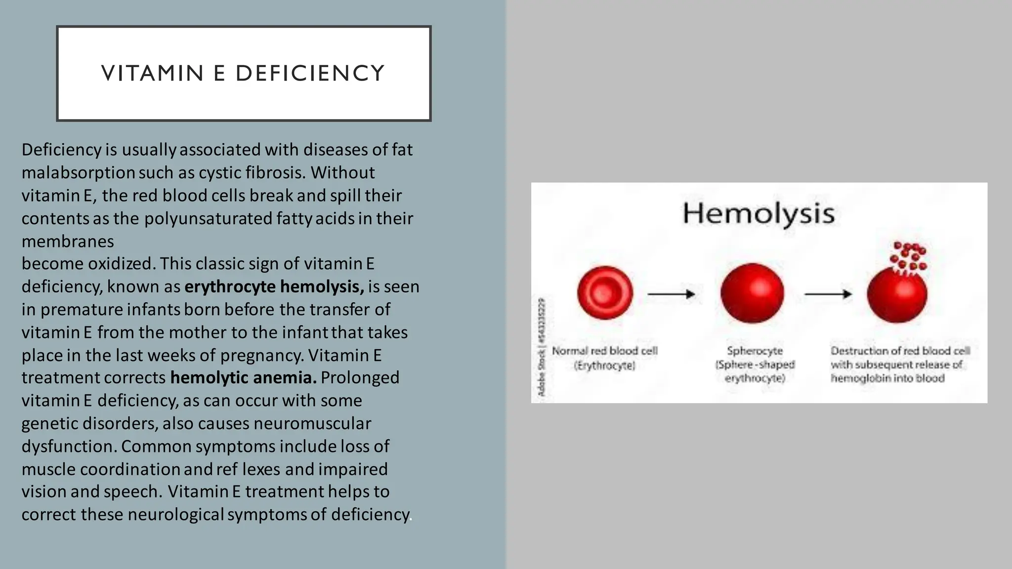 Vitamin E final presentation for Nutrition | PDF