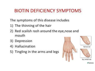 Biotin Deficiency Rash