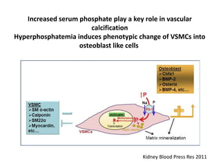 Vitamin k and vascular calcification | PPT