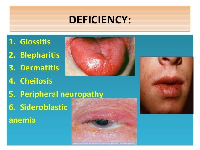 Medications That Cause Glossitis