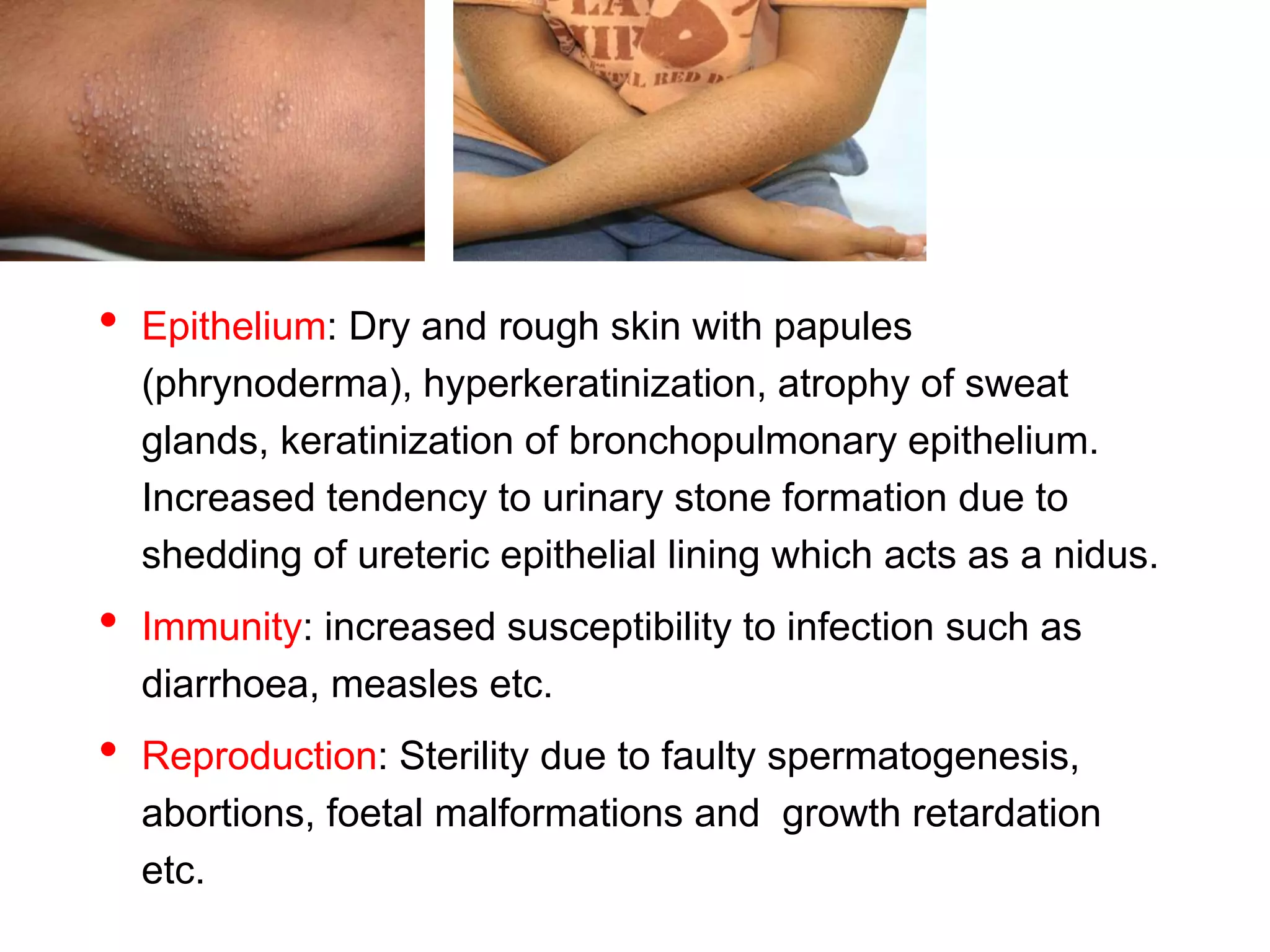 Vitamins water & fat Soluble | PPTX