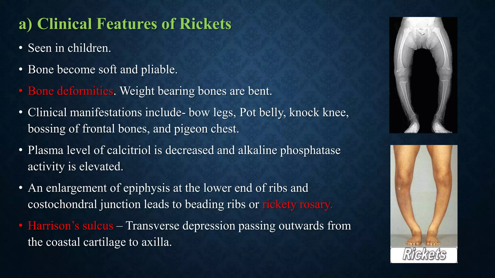 Fat Soluble Vitamins ppt | PPTX