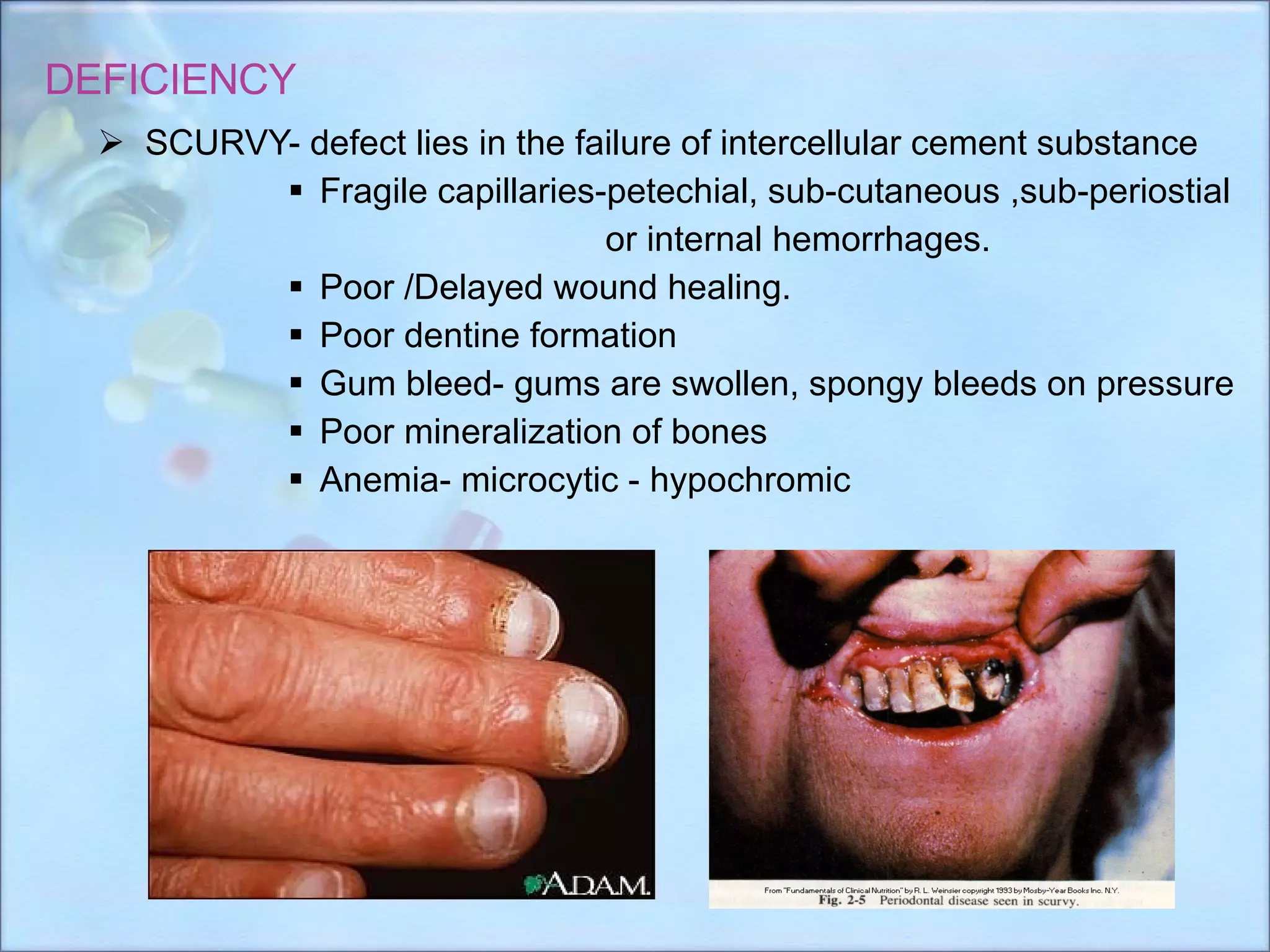 Vitamins Reqirement And Deficiencies | PPT