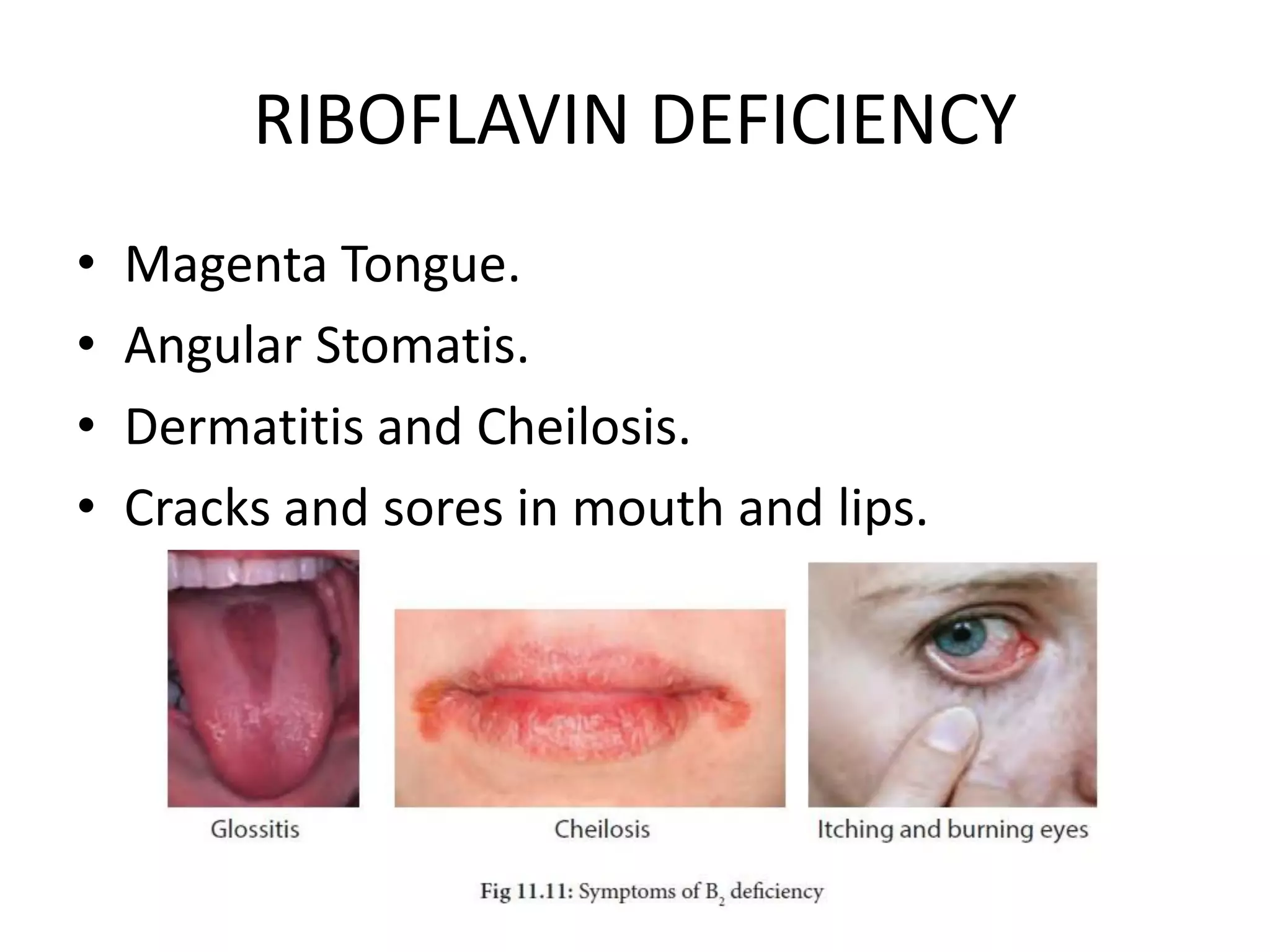 Vitamins B Complex | PDF