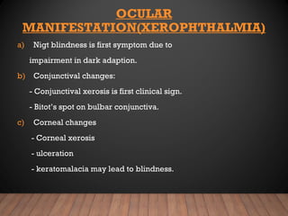 Vitamins a | PPT | Eye and Vision Conditions | Diseases and Conditions