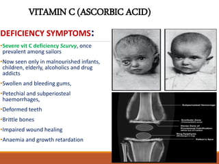Vitamins and anti oxidants pptx | PPTX