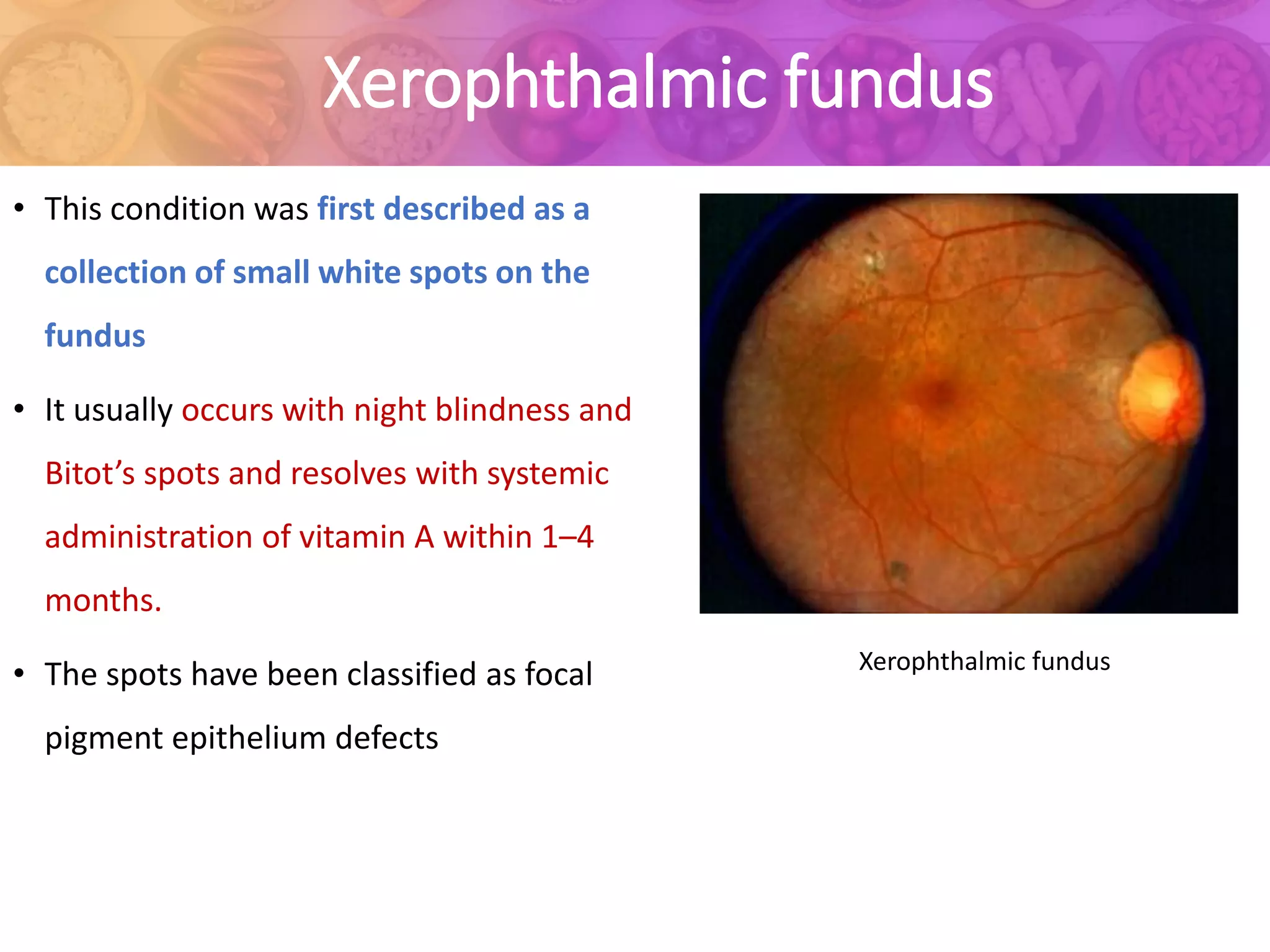 Vitamins and eye | PDF