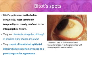 Vitamins and eye | PPT