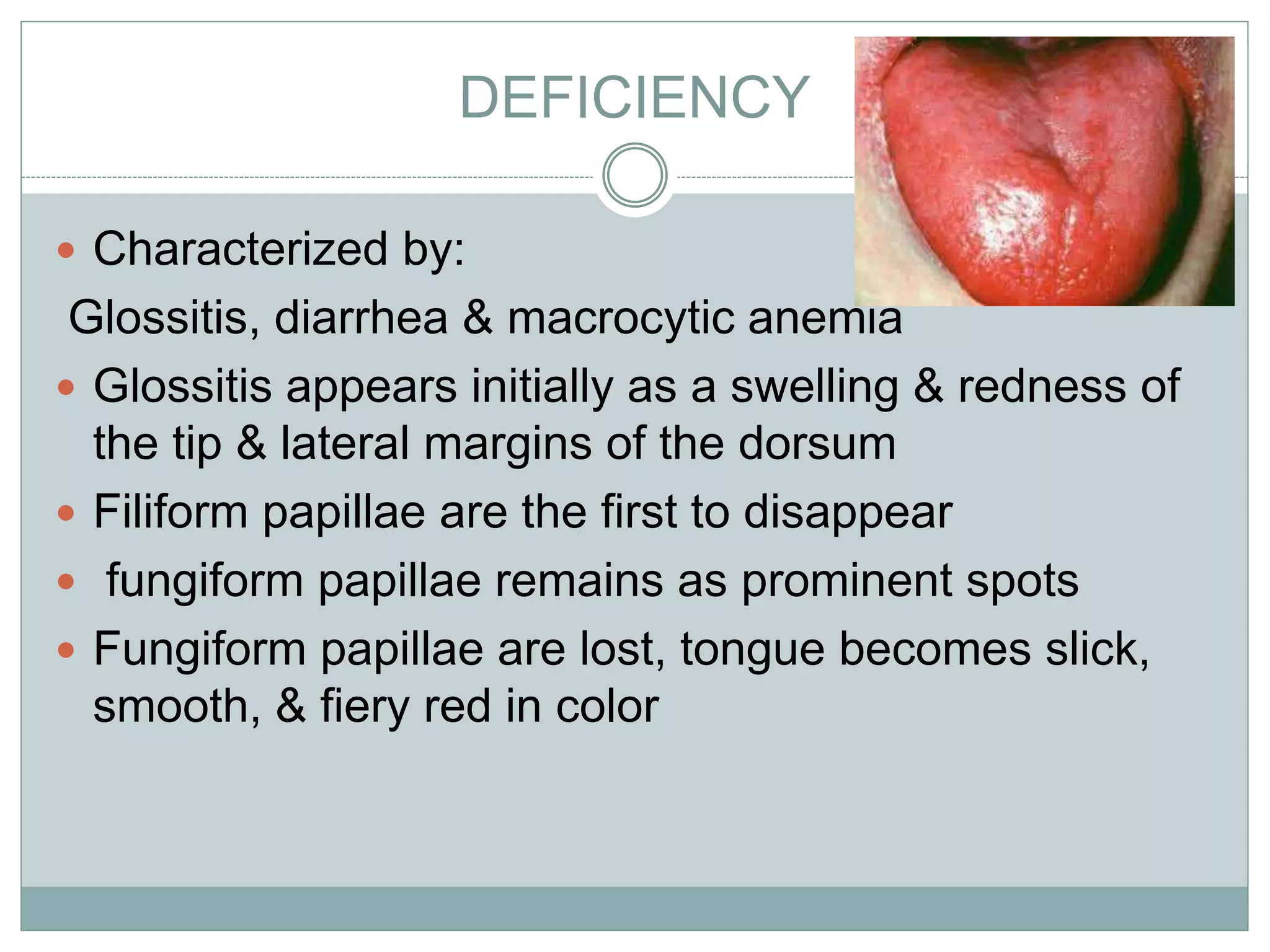 Vitamins and its oral manifestations | PPTX