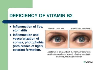 Vitamins of B group.ppt and it's function metabolism | PPT