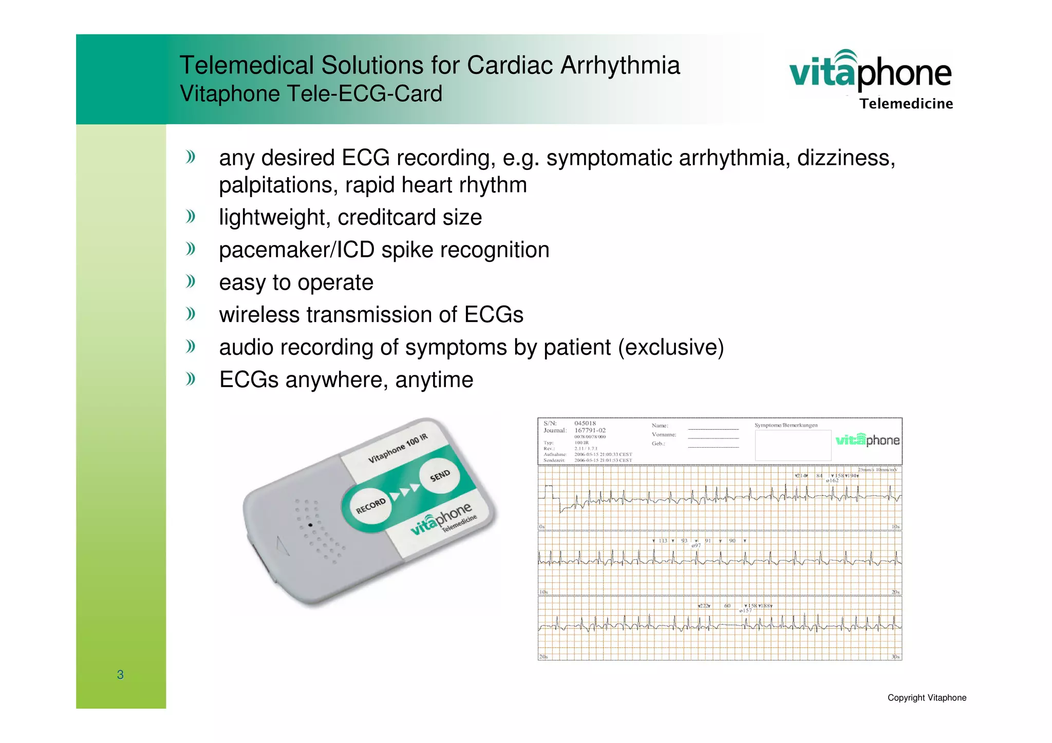 Vitaphone Tele Ecg System | PDF