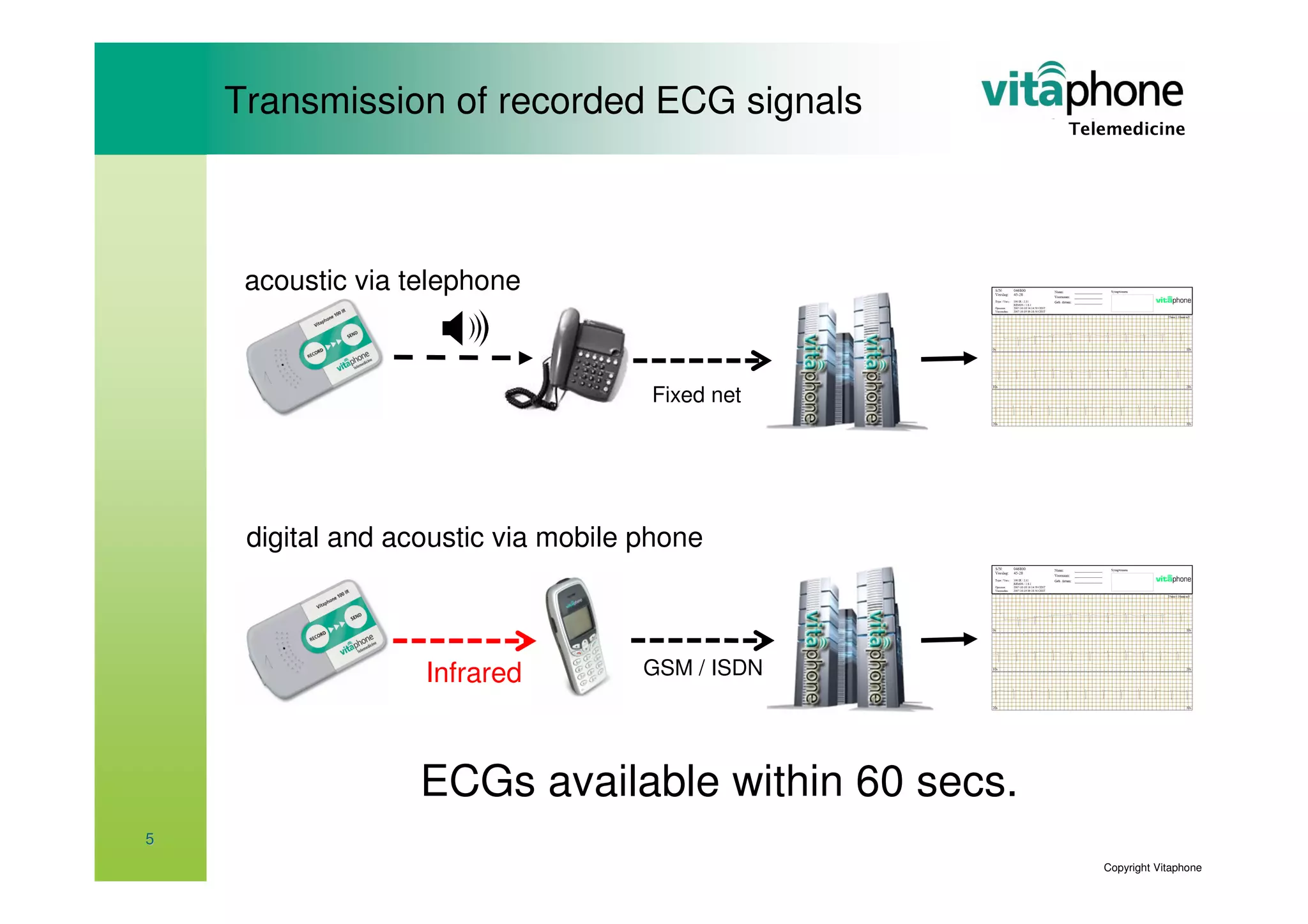 Vitaphone Tele Ecg System | PDF