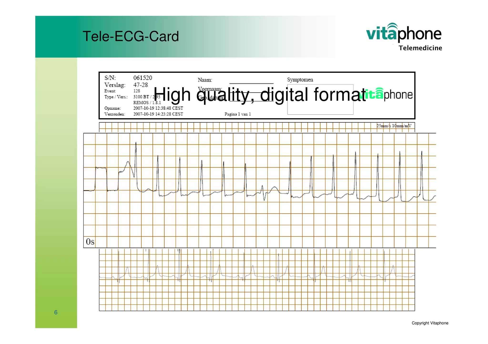 Vitaphone Tele Ecg System | PDF