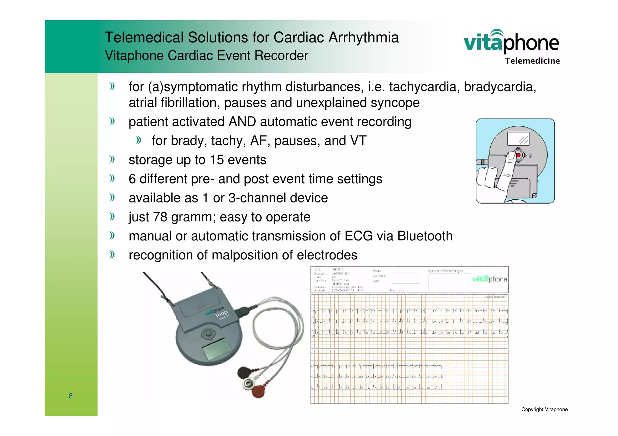 Vitaphone Tele Ecg System | PDF
