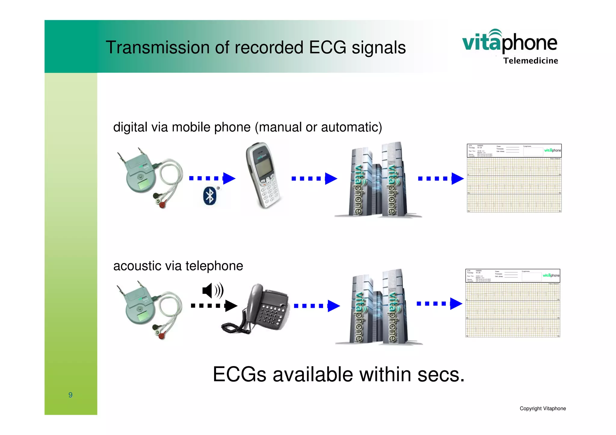 Vitaphone Tele Ecg System | PDF