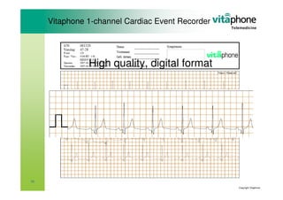 Vitaphone Tele Ecg System | PDF