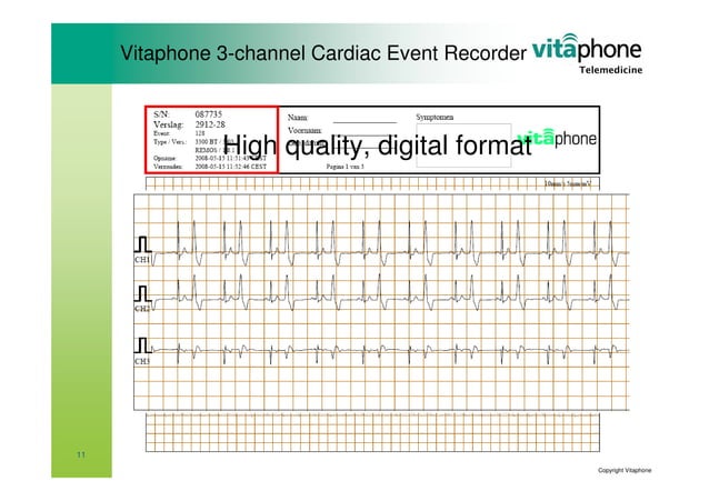 Vitaphone Tele Ecg System | PDF