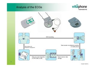 Vitaphone Tele Ecg System | PDF