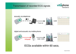 Vitaphone Tele Ecg System | PDF