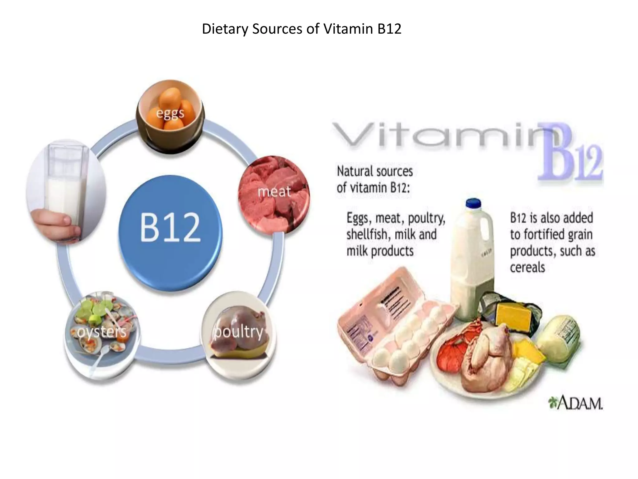 Vit b12 deficiency causes and management | PPTX