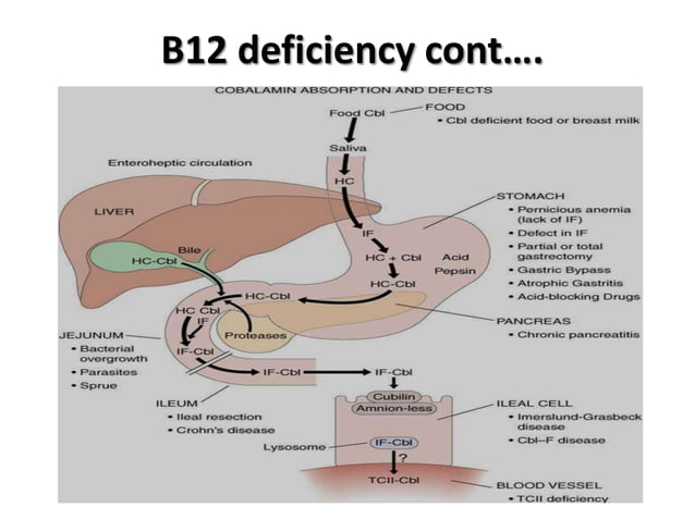Vit b12 deficiency causes and management | PPTX | Digestive Disorders ...