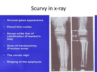 Vit defficiency, micro, obesity_ consized.ppt